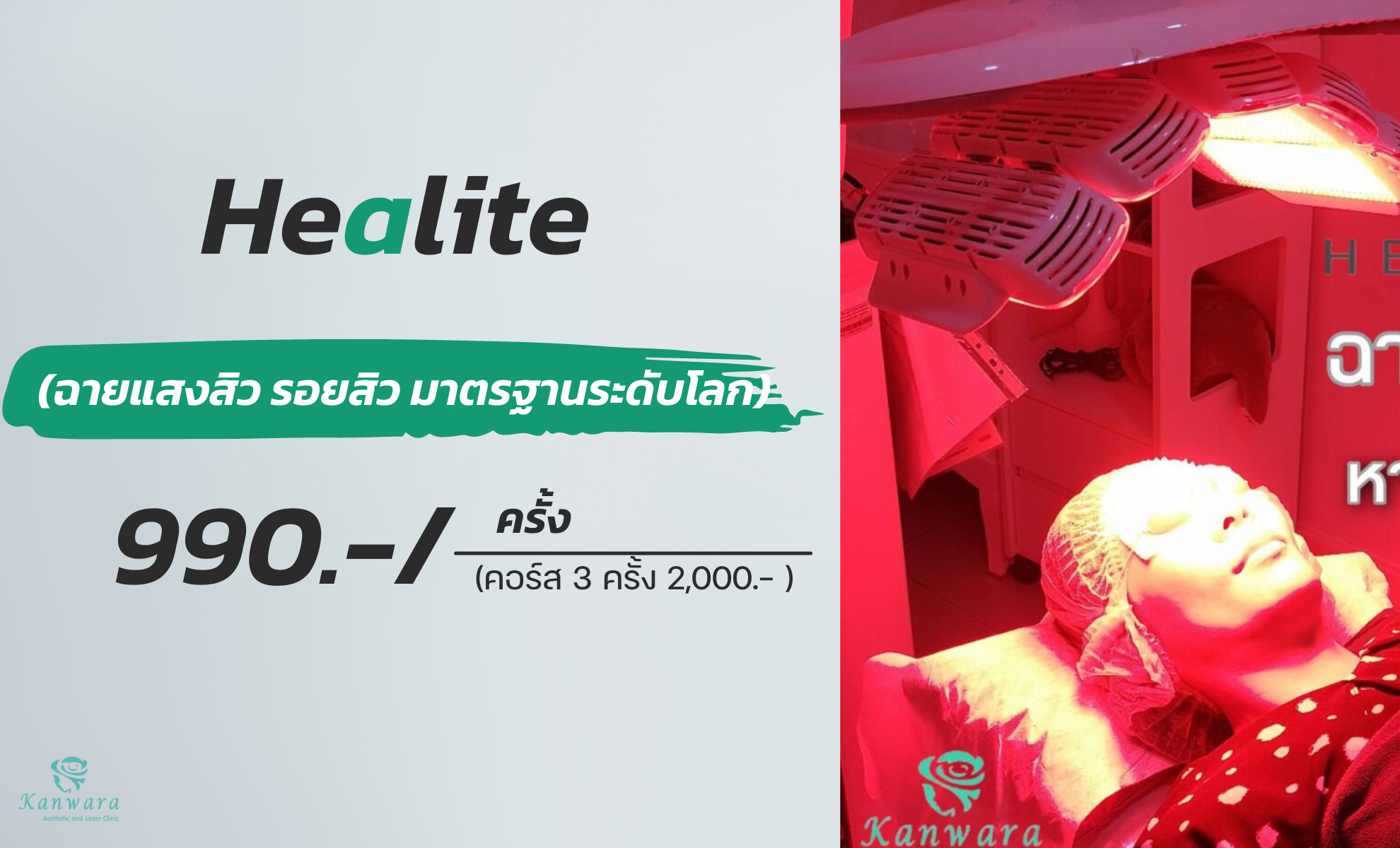 คอร์สรักษาสิว ราคาเริ่มต้น 860 กับโปรแกรมการรักษาทันสมัยกัญวราคลินิก ...