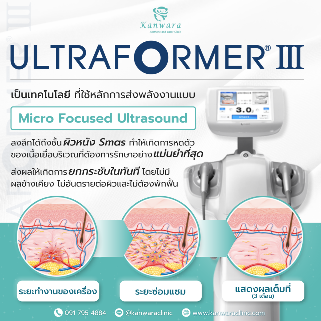 นวัตกรรม Ultraformer III ช่วยยกกระชับผิวหน้า สลายไขมันใต้ชั้นผิว ราคา ...